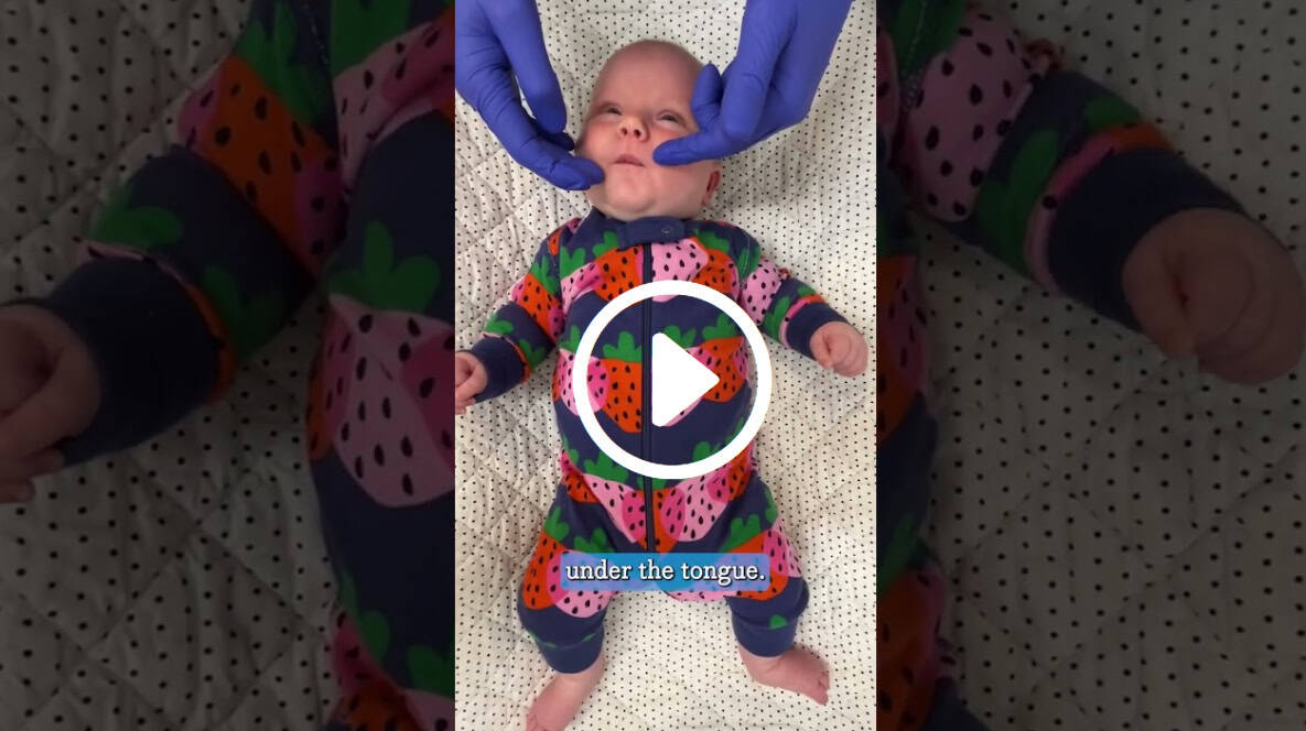 Tongue Tie Stretches Example Video Herre Holistic Dental Kc